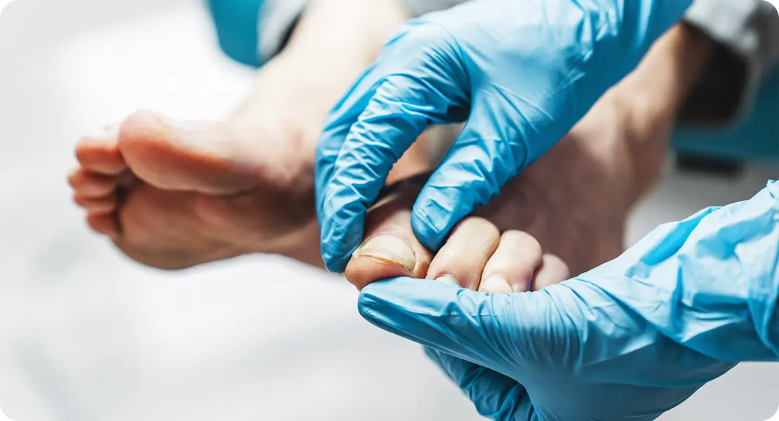 Skin Conditions Mistaken for Fungal Infections (Guide)