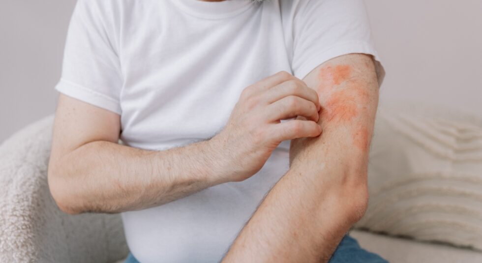 Skin Irritation vs Inflammation: Key Differences (Guide)