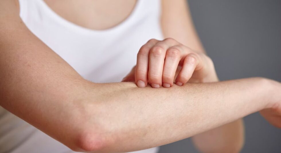 Itchy Skin with No Rash: Causes Explained (Guide)