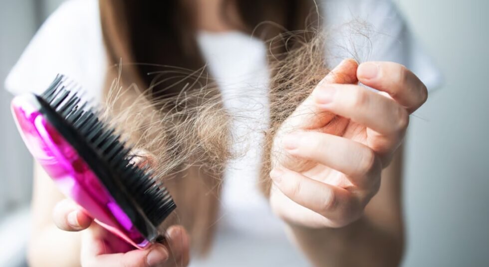 Female Pattern Hair Loss: Causes & Treatments (Guide)